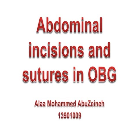 Abdominal Incisions and sutures | PPTX