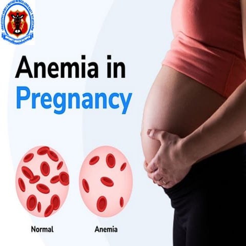 Obgyn_Anemia_in_Pregnancy_for_UG_class.ppt
