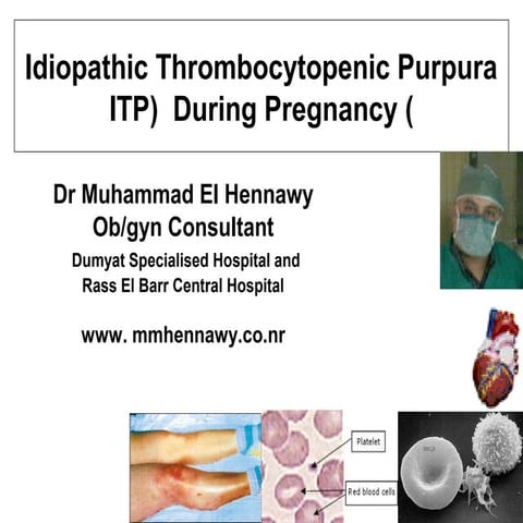 idiopathic thrombocytopenic purpura | PPT