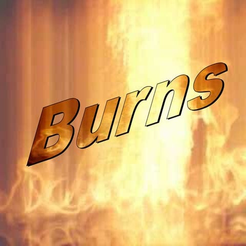Objective 60, Burns PP.PPT in adults and children | PPT