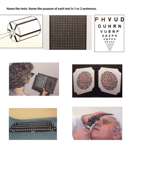 Hess Screen Test Explained: Methodology, Applications & Clinical ...