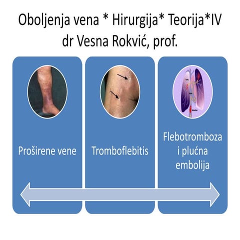 Oboljenja vena | PPTX
