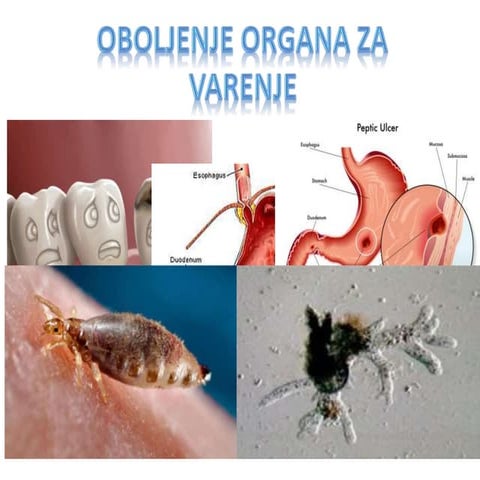 Oboljenje organa za varenje | PPTX