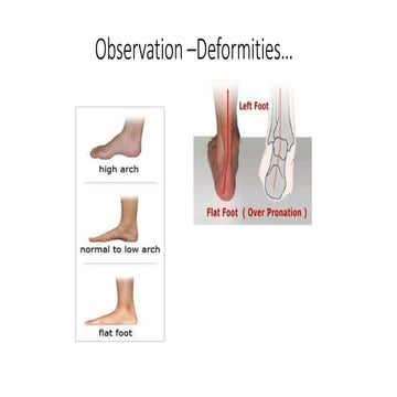 Observation –Deformities.pptx