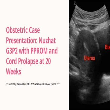 Obstetric-Case-Presentation.pptxbbbjjjjjnkk | PPTX