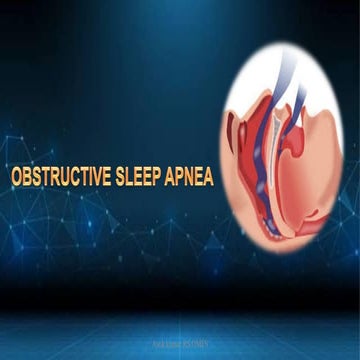 Obstructive sleep apnea | PPT