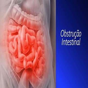Obstrução intestinal 2.pptx