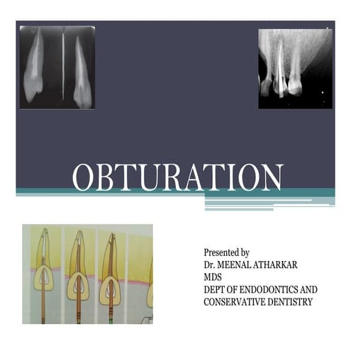 Obturation | PDF