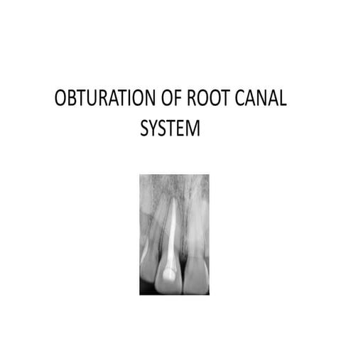 Obturation of root canal system | PPT