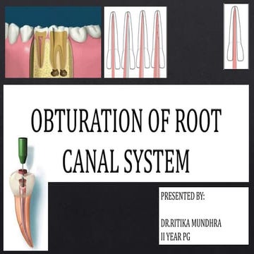 OBTURATION OF ROOT CANAL SYSTEM.pptx