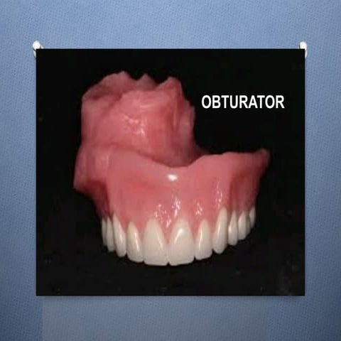 Obturators Pptx