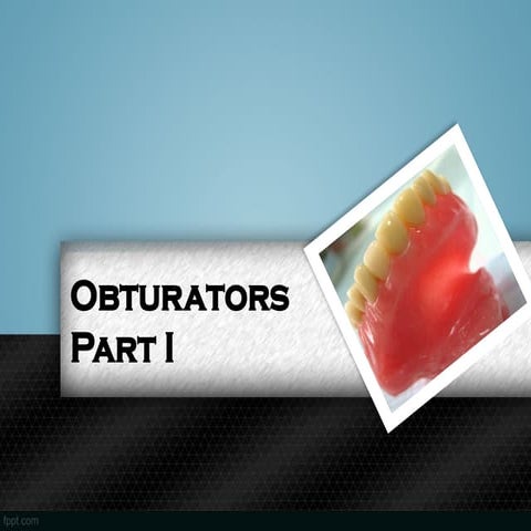 Obturator prosthesis for management of maxillary defects | PPTX