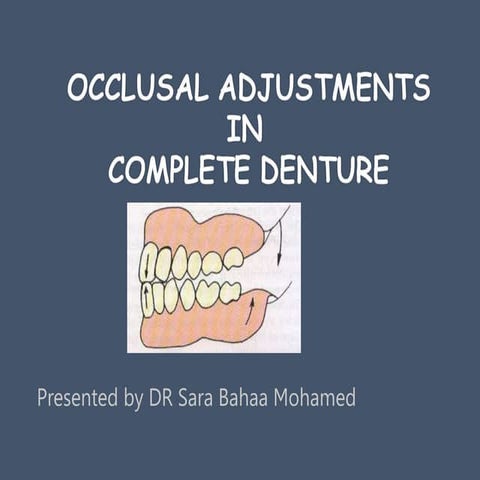 occlusal adjustment in cd.pptx