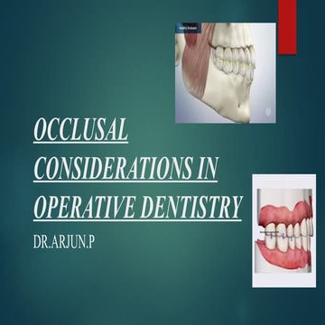 occlusal consideration s in operative dentistry.pptx
