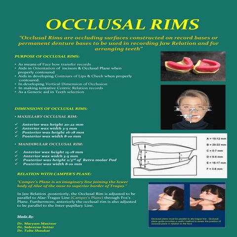 OCCLUSAL RIMS.pptx
