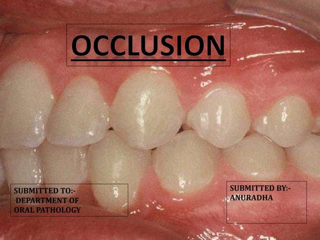Occlusion | PPTX Occlusion | PPTX