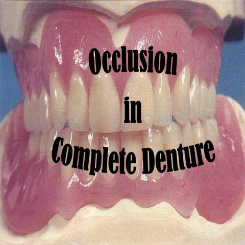 Occlusion in complete denture basic concept | PDF
