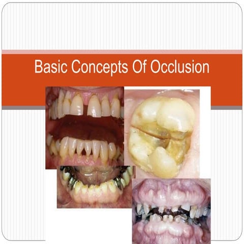 Occlusion basic | PPTX