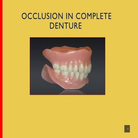 OCCLUSION IN COMPLETE DENTURE - Copy.pptx