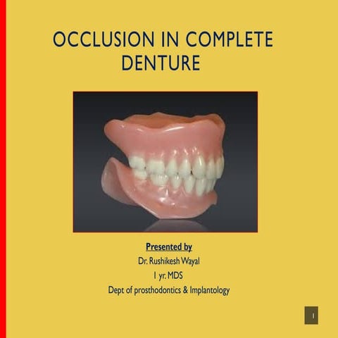 OCCLUSION IN COMPLETE DENTURE - Copy [Autosaved].pptx