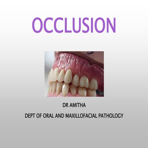 OCCLUSION | PPT