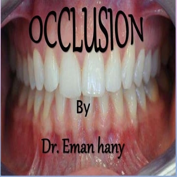 Occlussion | PPT