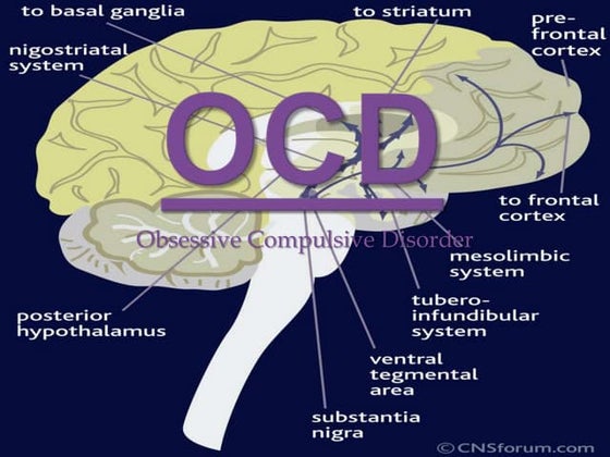 Obsessive compulsive disorder | PPT | Brain and Nervous System ...