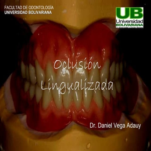 GUIA ANTERIOR OCLUSION | PPTX