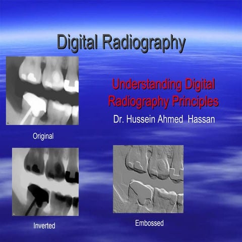 Computed radiography and digital radiography- CR/DR | PPTX
