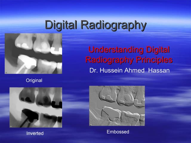Computed radiography and digital radiography- CR/DR | PPTX
