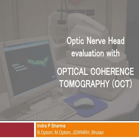Optical coherence tomography and its principle