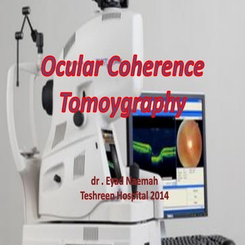 Optical coherence tomography and its principle