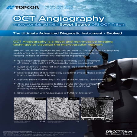 Oct angiography | PDF