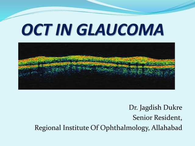 Glaucoma (opthalmology) | PPTX