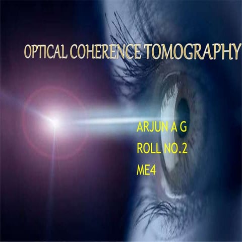 Optical coherence tomography and its principle