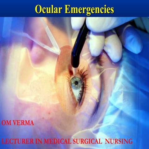 Ocular emergency- | PPT