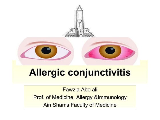 ALLERGIC CONJUNCTIVITIS.pptx