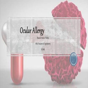 Ocular allergy rasoul amini | PPTX