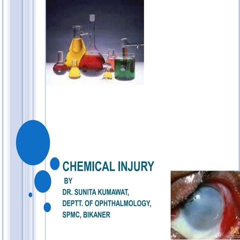 Ocular chemical injury | PPTX