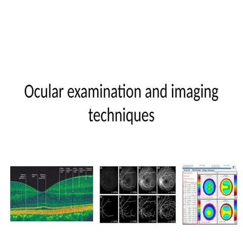 Ocular examination and imaging techniques.pptx