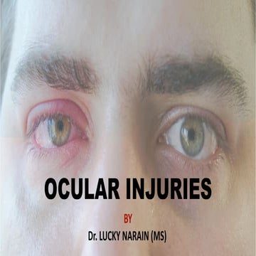 OCULAR INJURIES | PDF