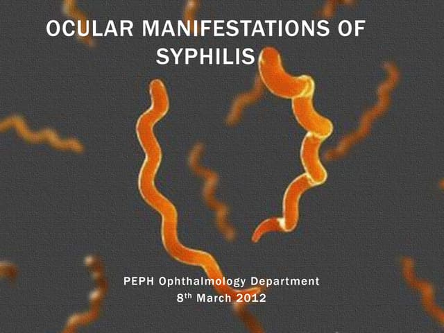 Pseudo membranous conjunctivitis | PPTX | Eye and Vision Conditions ...