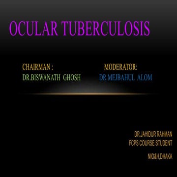 Ocular tb | PPTX