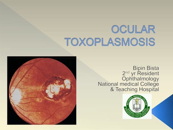 Oculartoxoplasmosis 140321025910-phpapp01 | PPT