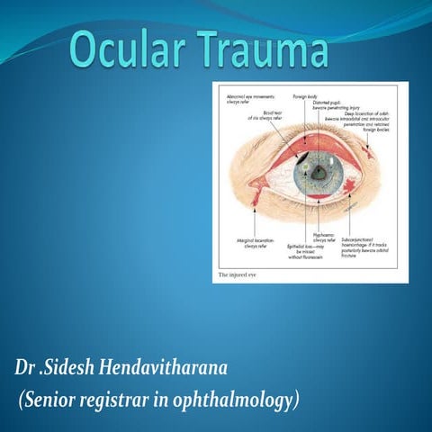 Ocular trauma | PPT