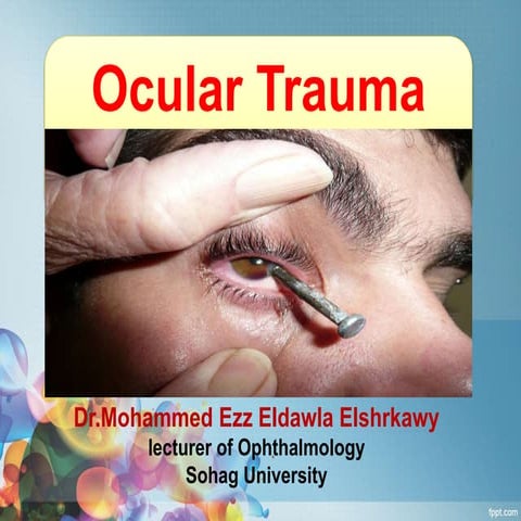Ocular trauma | PPT