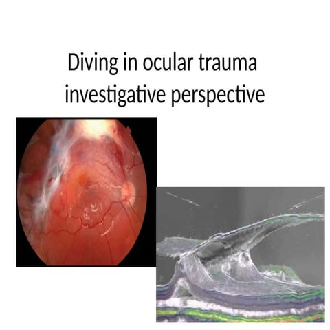 investigations for ocular trauma. how to diagnose | PPTX