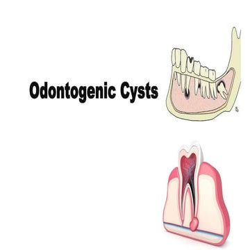 Classification and management Odontogenic cysts of oral cavity | PPTX