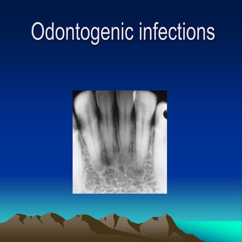 Odontogenic infection | PPT