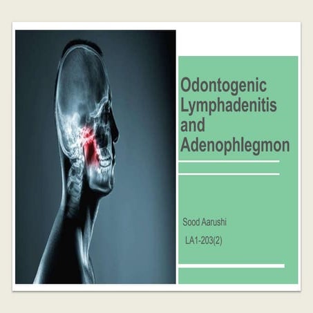 Odontogenic lymphadenitis and Adenophlegmon.pptx